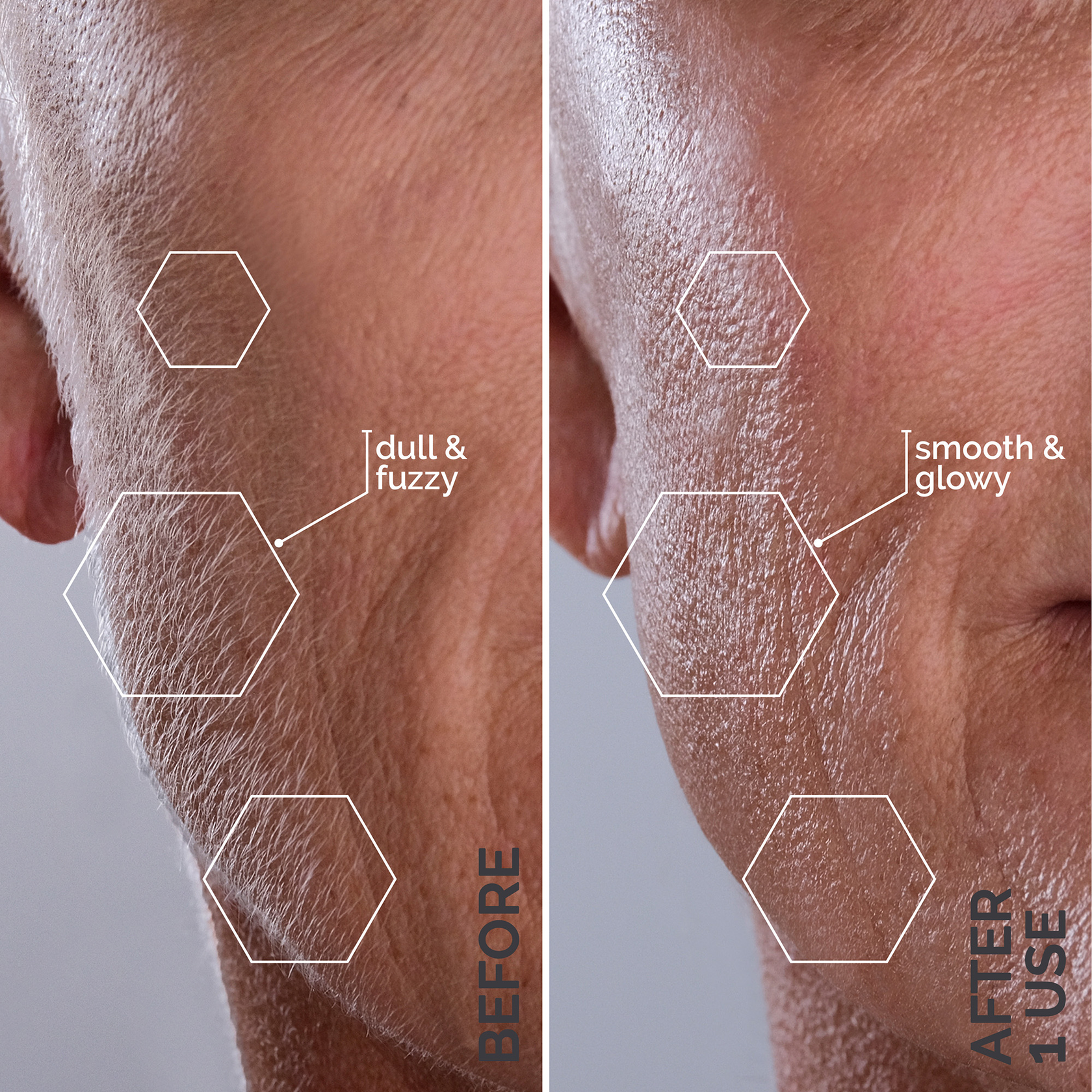 Sonicsmooth | Sonic Dermaplaning System by Michael Todd Beauty